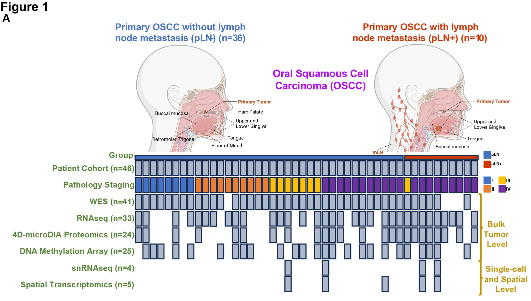 HKU researchers uncover key mechanisms driving oral cancer spread and ...